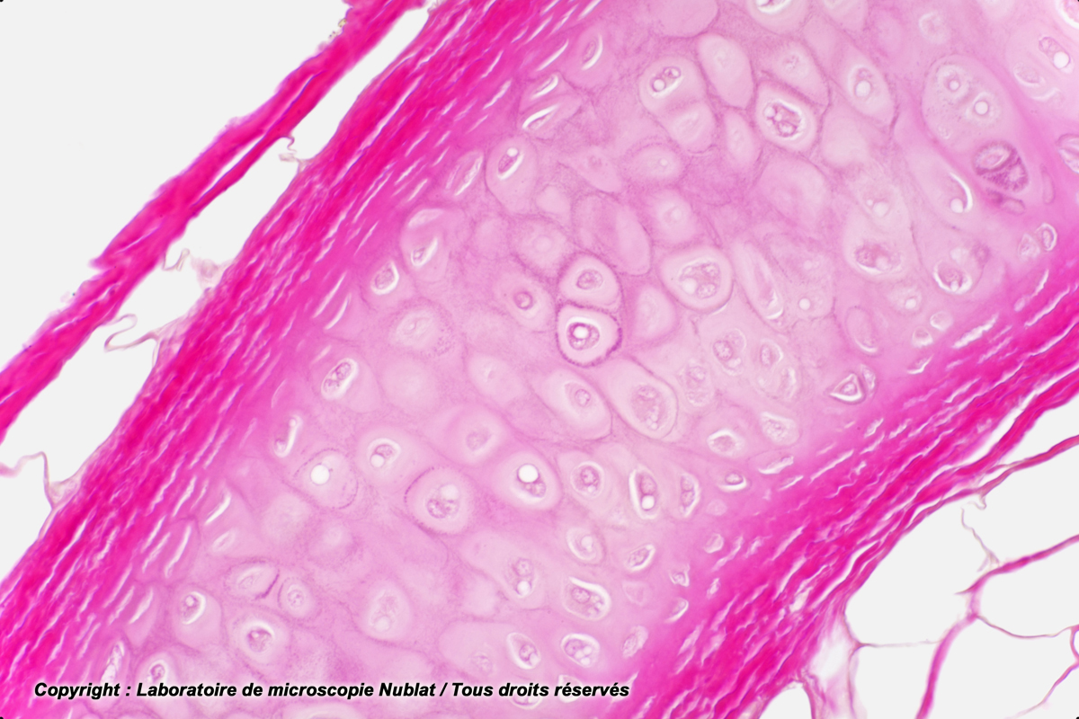 Cartilage hyalin (app. xyphoïde), HE