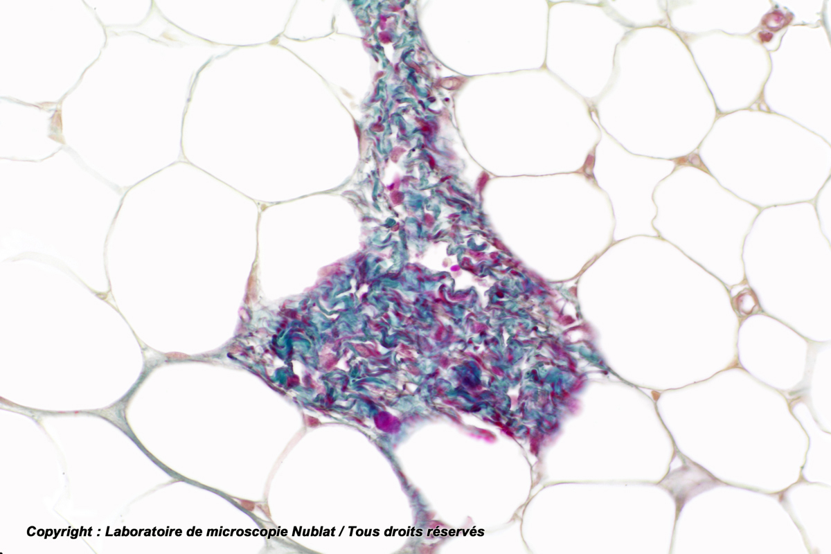 Tissu adipeux non dégraissé, AO