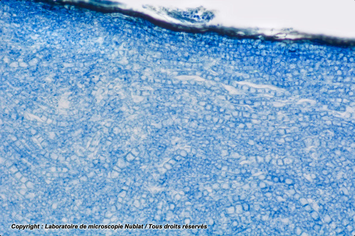 Ergot de seigle, CT, BT