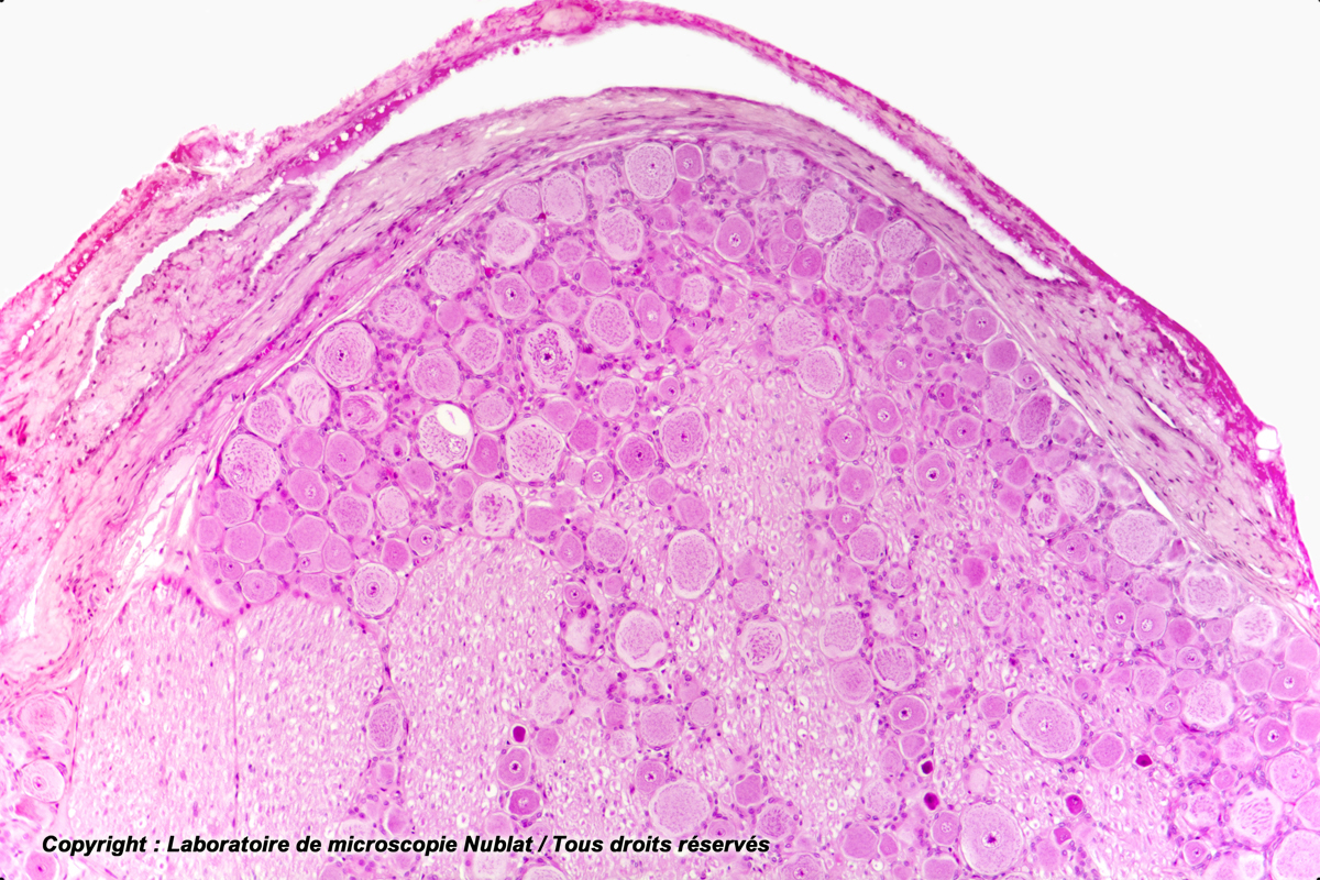 Ganglion rachidien, CT, HE