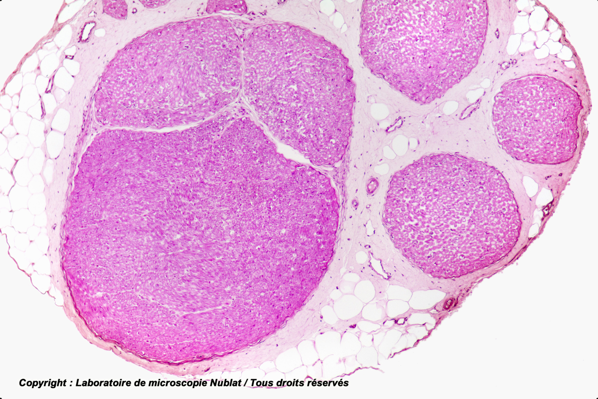 Nerf, CL, Mammifère, HE