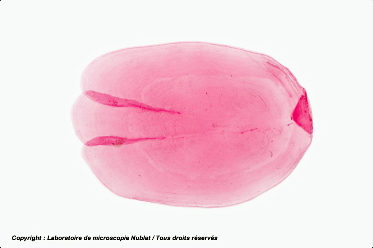 Ecaille de poisson, type cycloïde, Brochet, CBA
