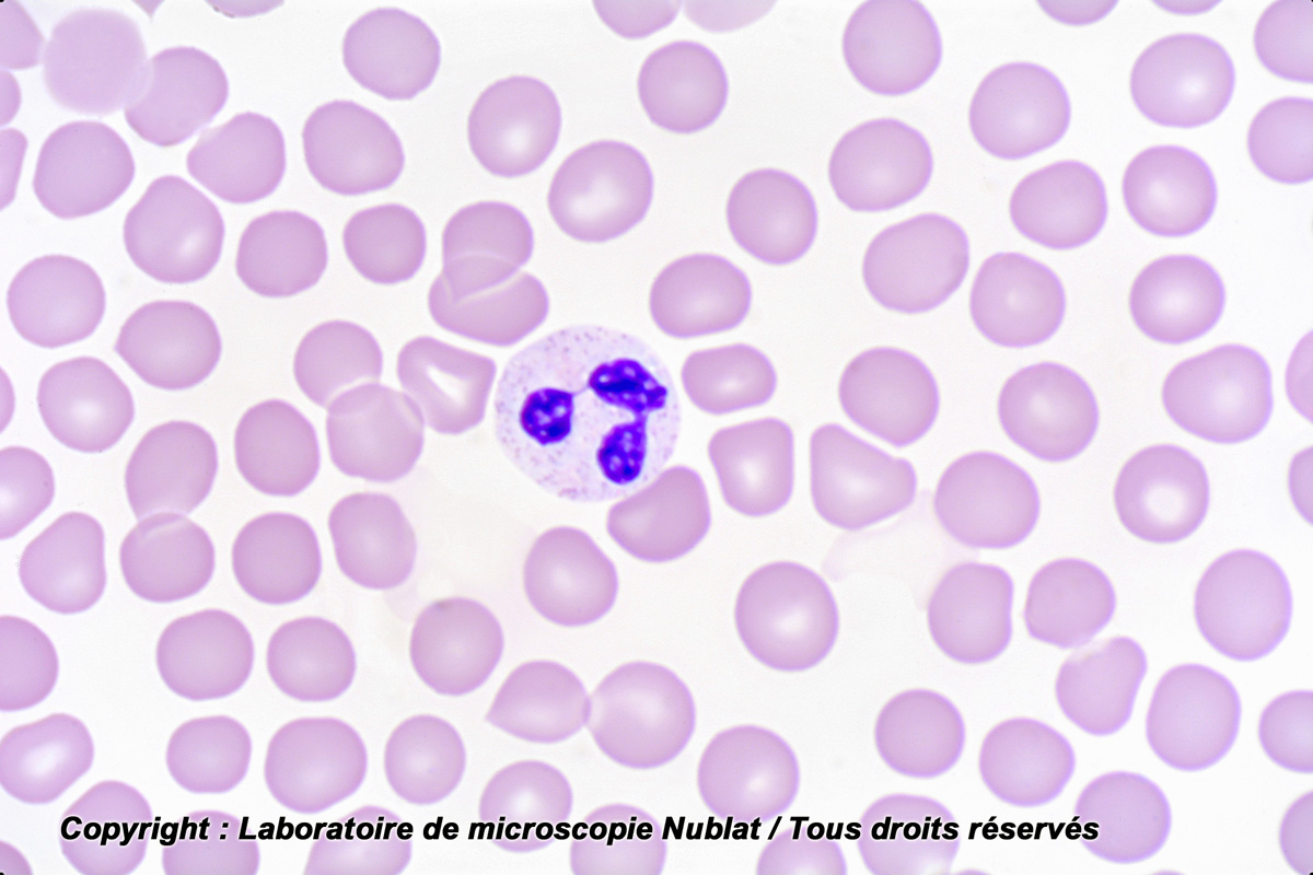 Sang humain, détail globules blancs, frottis, G