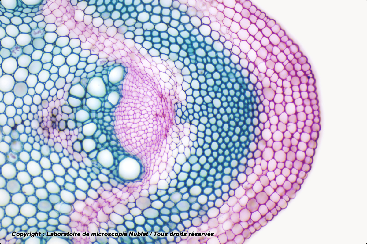 Collenchyme et sclérenchyme, tige de Clématite, CT, CV