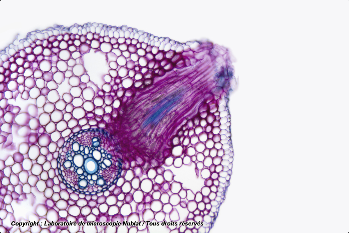 Naissance d’une radicelle, CT, CV
