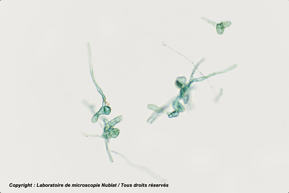 Moss Protonema Slide
