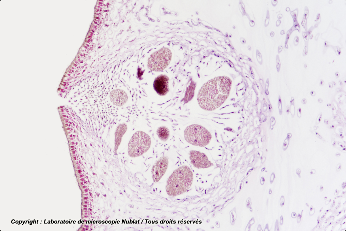 Fucus dioïque, conceptacles femelles, CT, HE