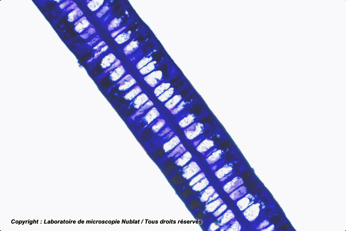 Ulve, Thalle, CT, BT