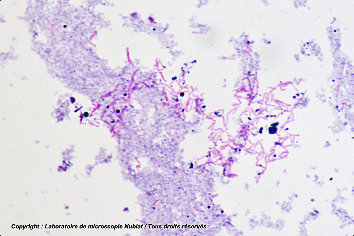 Bacille tuberculeux de Koch, culture, Ziehl Neelsen