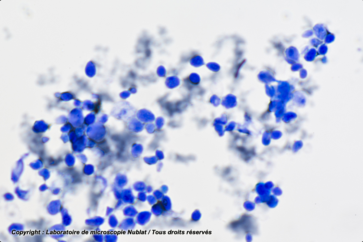 Levure en bourgeonnement, BM