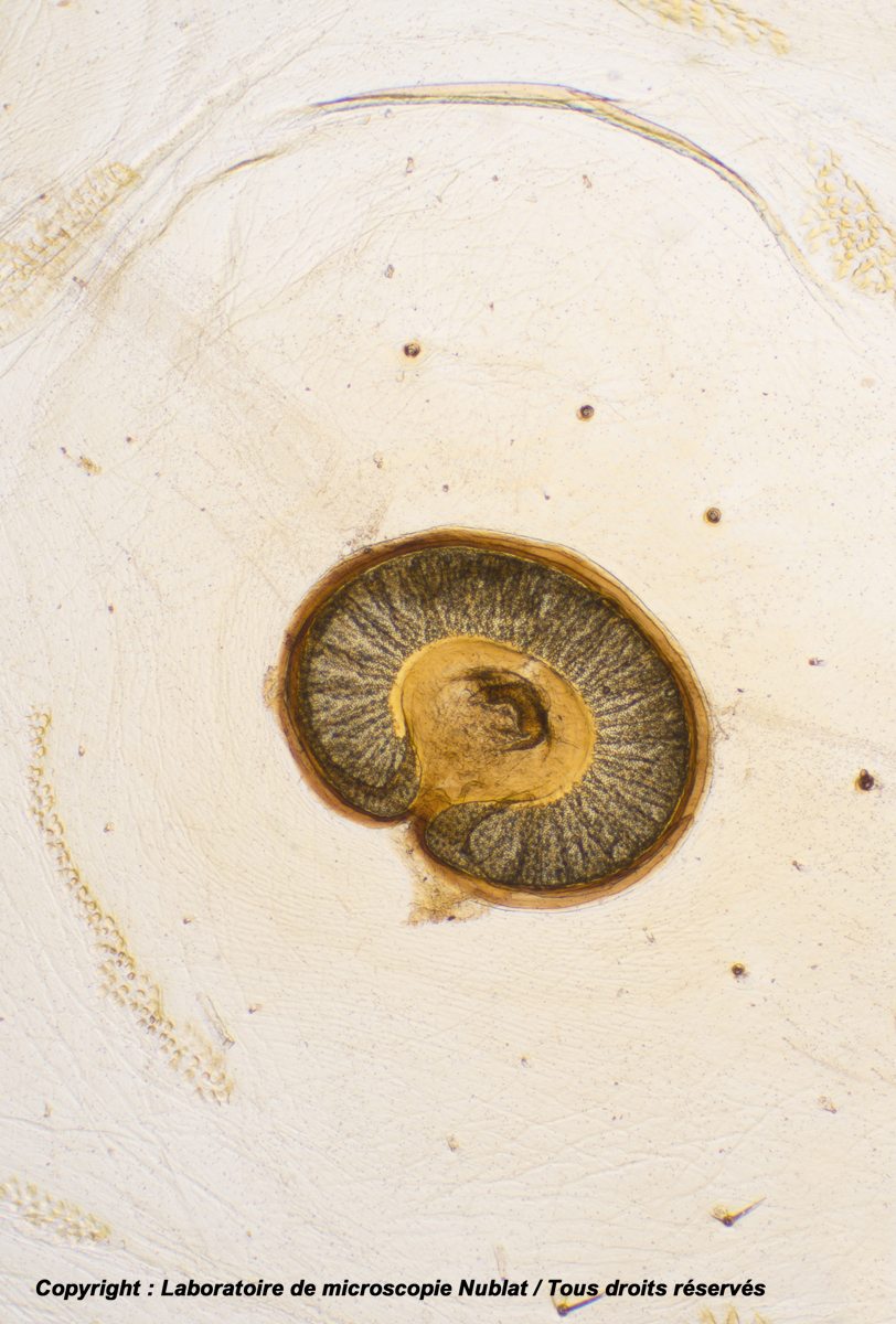 Stigmate d’insecte, CN