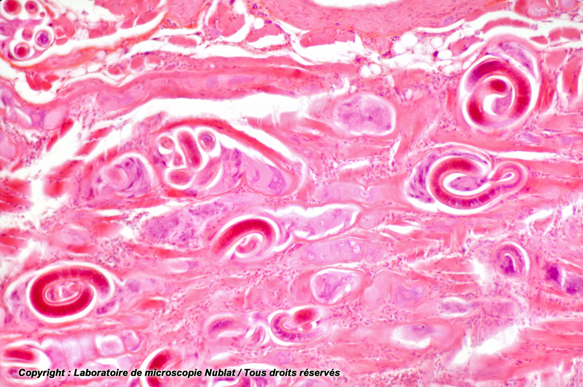 Coupe de muscle trichiné (Trichinella spiralis), HE